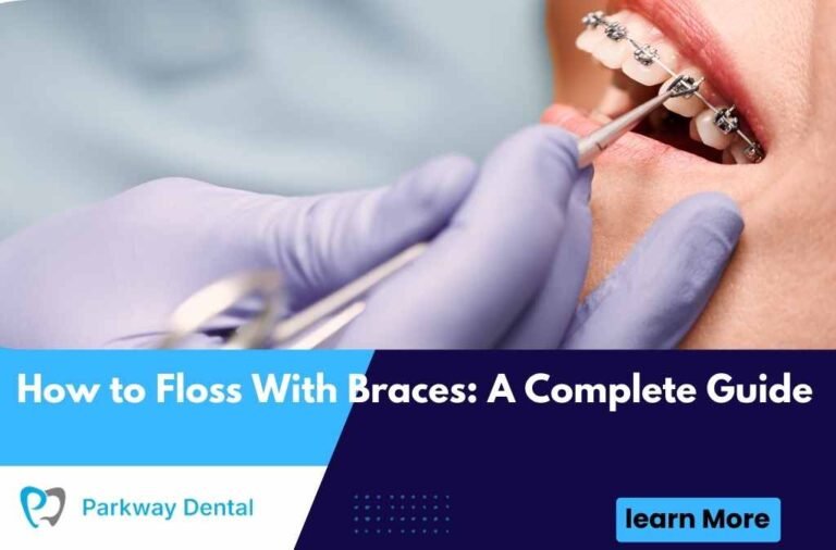 How to Floss With Braces: A Complete Guide | Parkway Dental