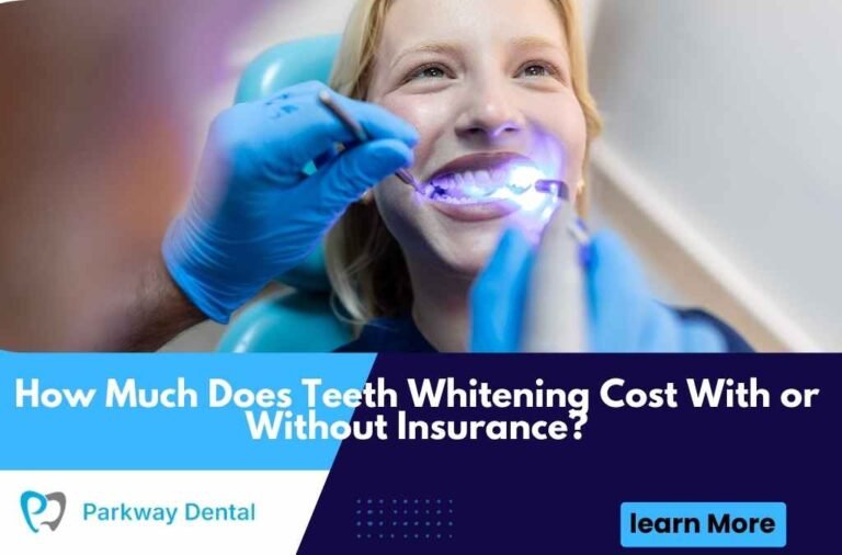 How Much Does Teeth Whitening Cost With or Without Insurance? | Parkway ...