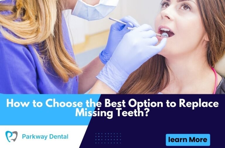 How to Choose the Best Option to Replace Missing Teeth? | Parkway Dental