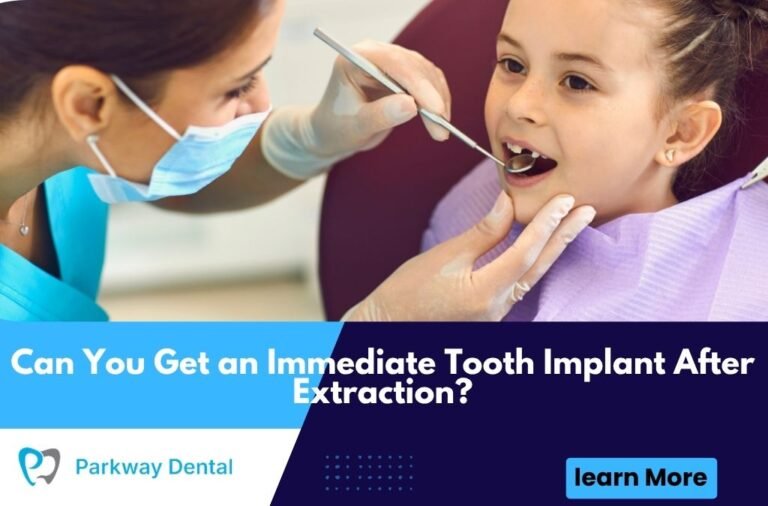 Can You Get an Immediate Tooth Implant After Extraction? | Parkway Dental