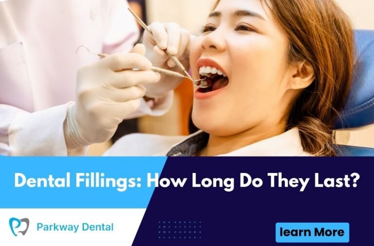 Dental Fillings: How Long Do They Last? | Parkway Dental