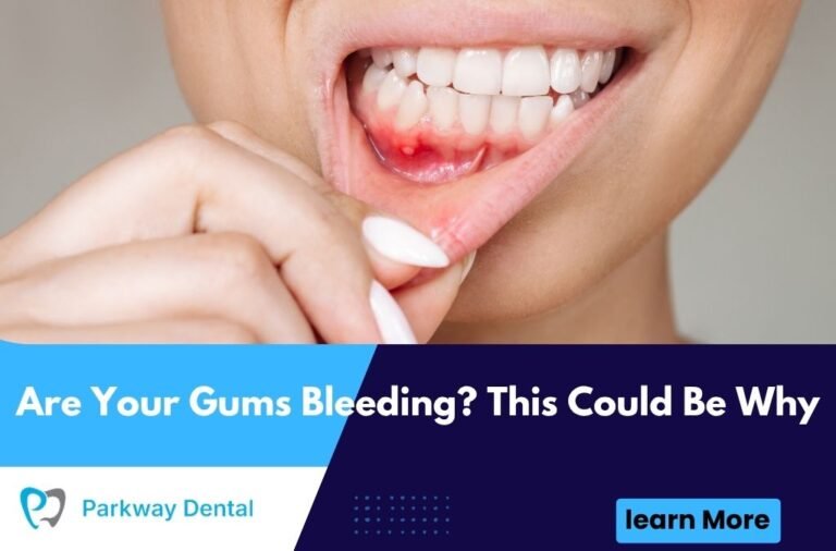 Are Your Gums Bleeding? This Could Be Why | Parkway Dental