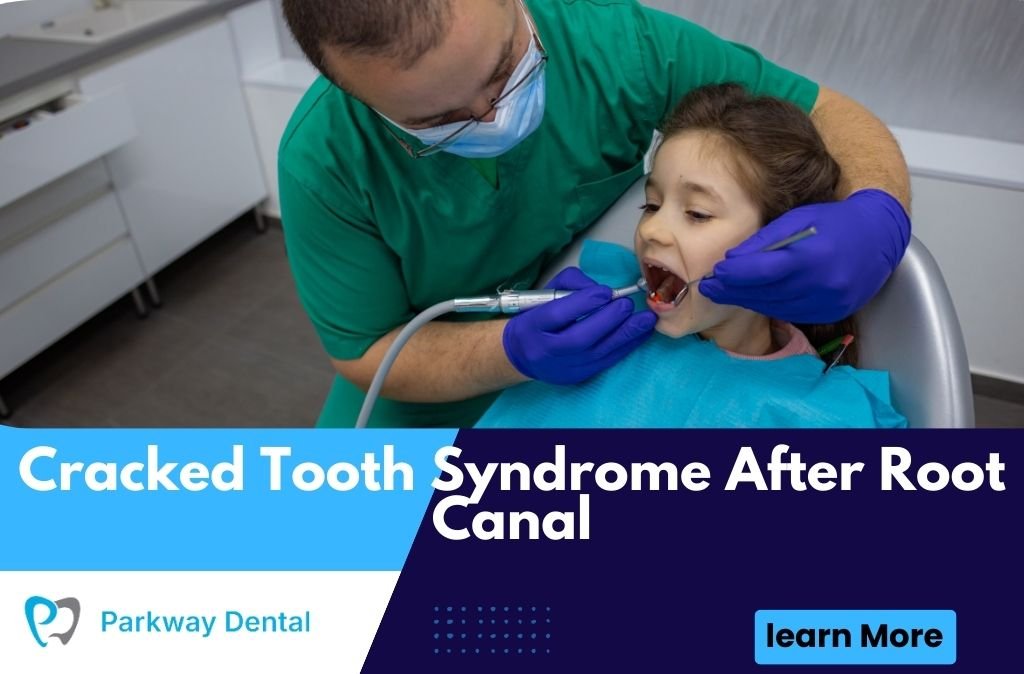 Cracked Tooth Syndrome After Root Canal | Parkway Dental