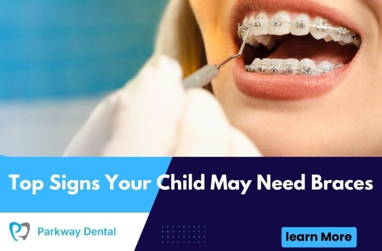 Top Signs Your Child May Need Braces | Parkway Dental