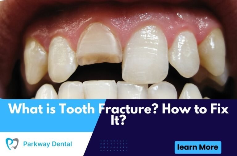What is Tooth Fracture? How to Fix It? | Parkway Dental