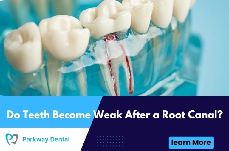Do Teeth Become Weak After a Root Canal? | Parkway Dental