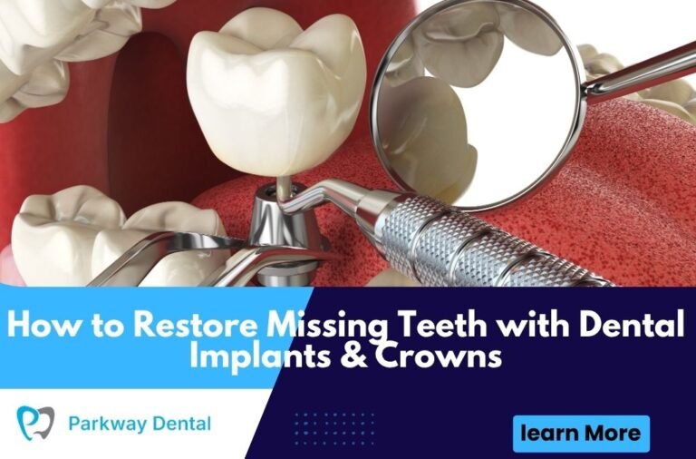 How to Restore Missing Teeth with Dental Implants & Crowns | Parkway Dental