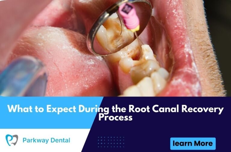What to Expect During the Root Canal Recovery Process | Parkway Dental