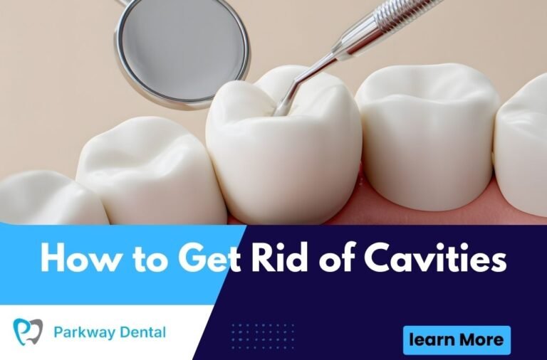 How to Get Rid of Cavities | Parkway Dental